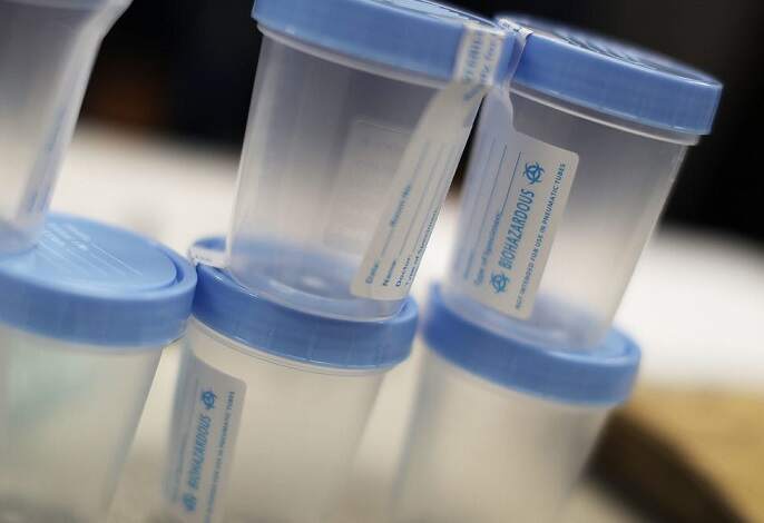 Does CVS Drug Test in [year]? (Everything You Need to Know)